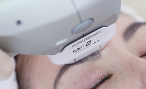 What to expect | ULTRAFORMER